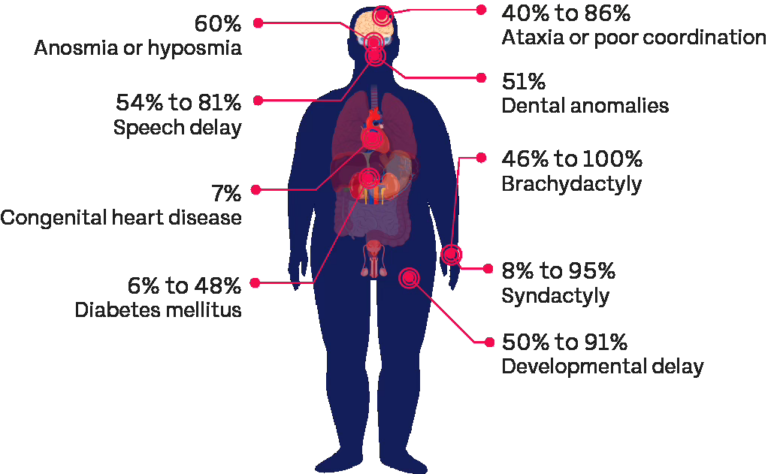 Diagnosing Bardet-Biedl Syndrome - Rhythm Pharmaceuticals HCP Site